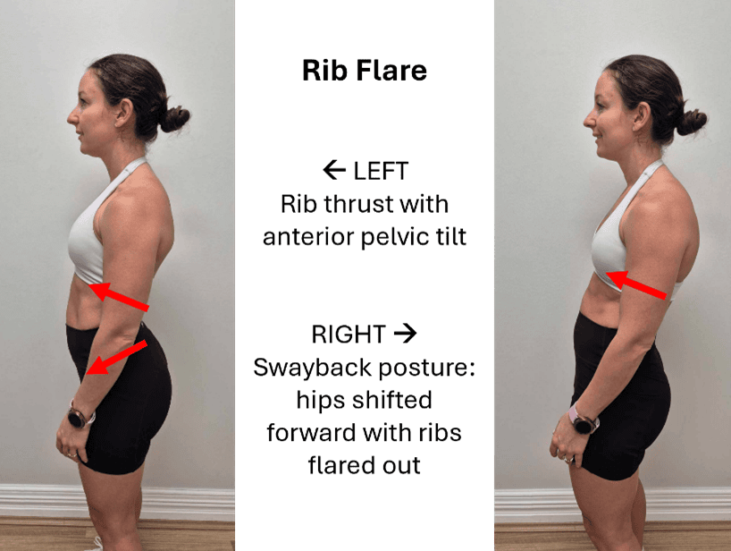 Rib Flare What Is It And How Can You Fix It Roar Physiotherapy Rib Flare What Is It And How Can You Fix It Roar Physiotherapy